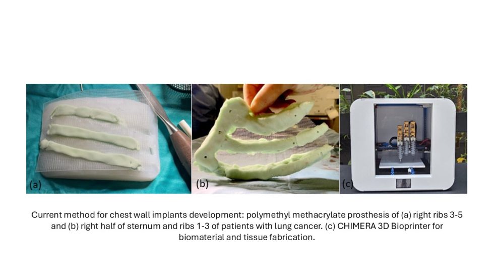 Development Of Bone Implants Using Tissue Engineering And Bioprinting 5119