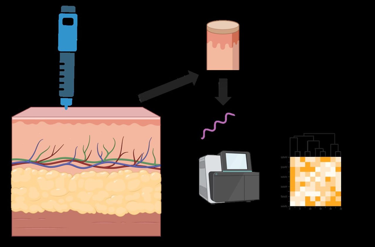 Development of a skin microbiopsy device for next generation ...
